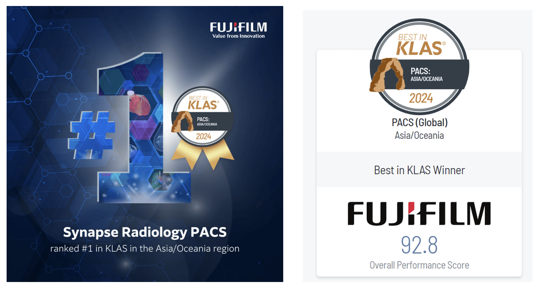 Synapse Radiology PACS ของฟูจิฟิล์ม ได้รับรางวัล “Best in KLAS”ในฐานะ ...
